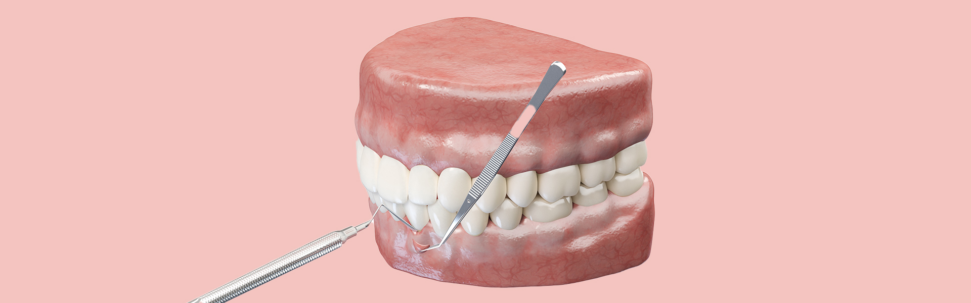 Achieve a Balanced Smile with Precision Gum Contouring
